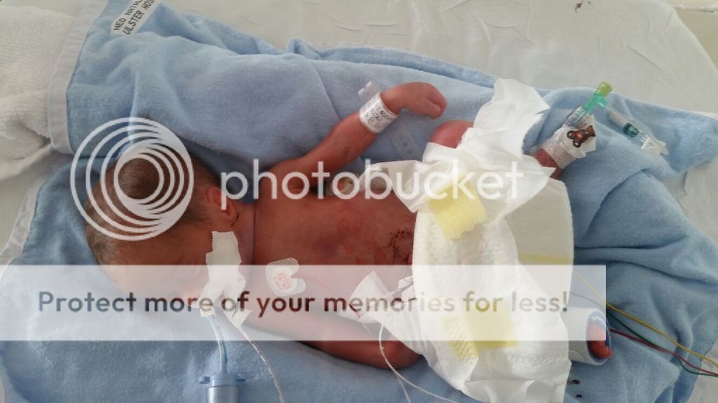 Born 28weeks 2lb 5oz - BabyCentre